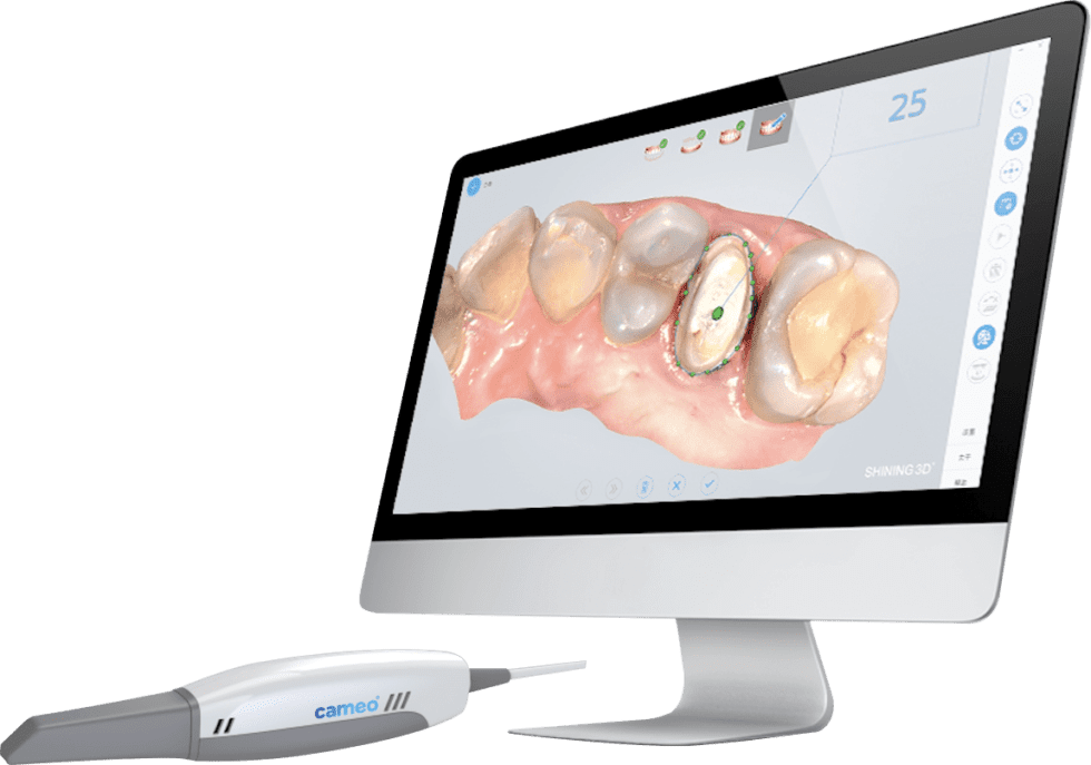 Cameo 3D Intraoral Scanner | RF America IDS